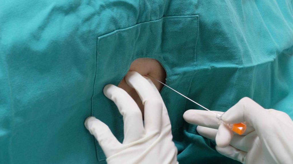 Punção lombar: Indicações, contraindicações, técnica e complicações - CUREM