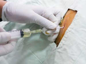 Como diagnosticar a TVP na emergência - CUREM